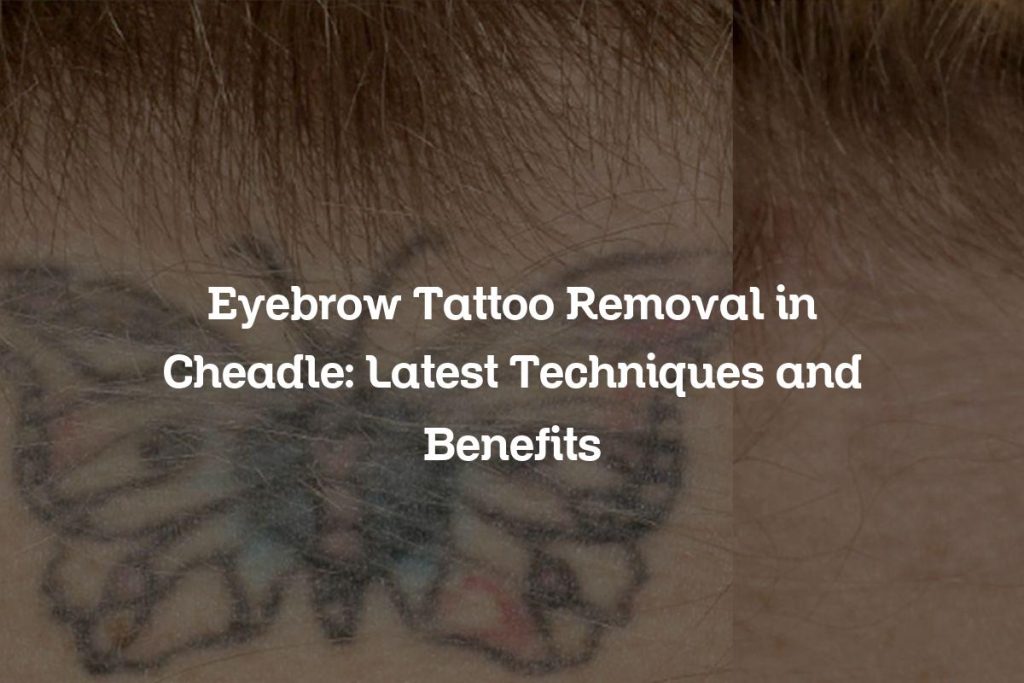 Eyebrow Tattoo Removal in Cheadle: Latest Techniques and Benefits ...